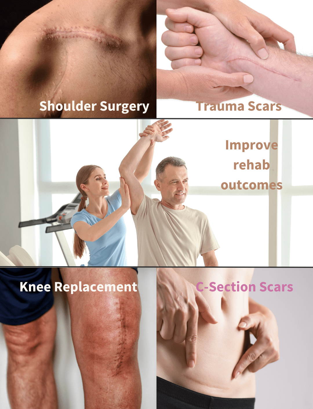 McLoughlin Scar Tissue Release | Mind Body Kinect